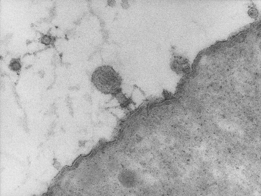 Tem Of T4 Bacteriophage Infecting E. Coli by Science Photo Library