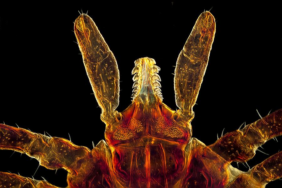 Tick, Light Micrograph by Science Photo Library
