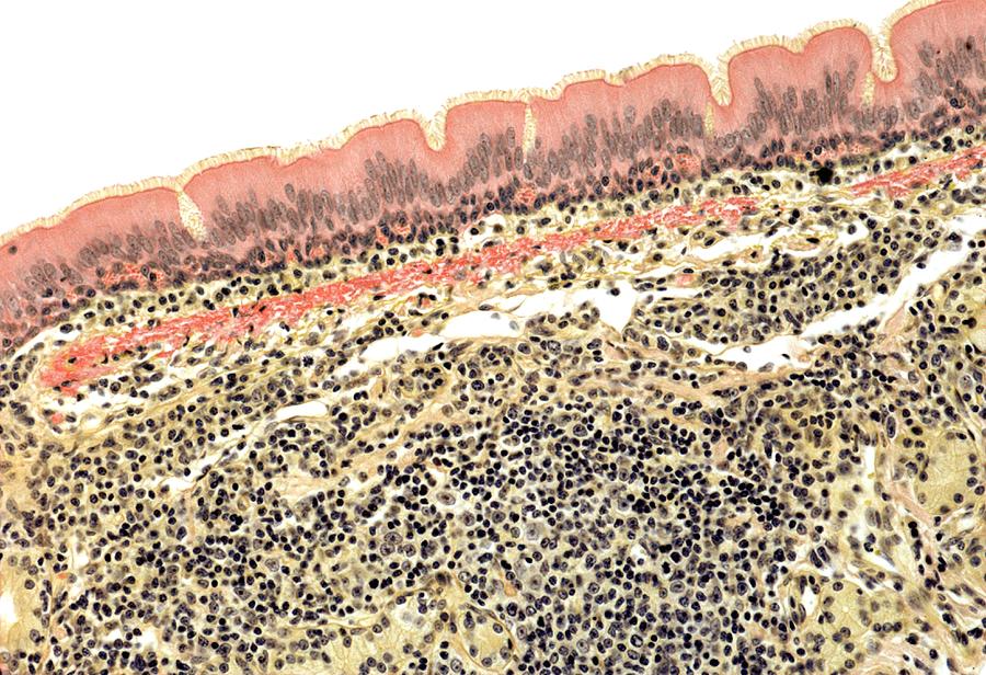 Trachea, Light Micrograph by Science Photo Library