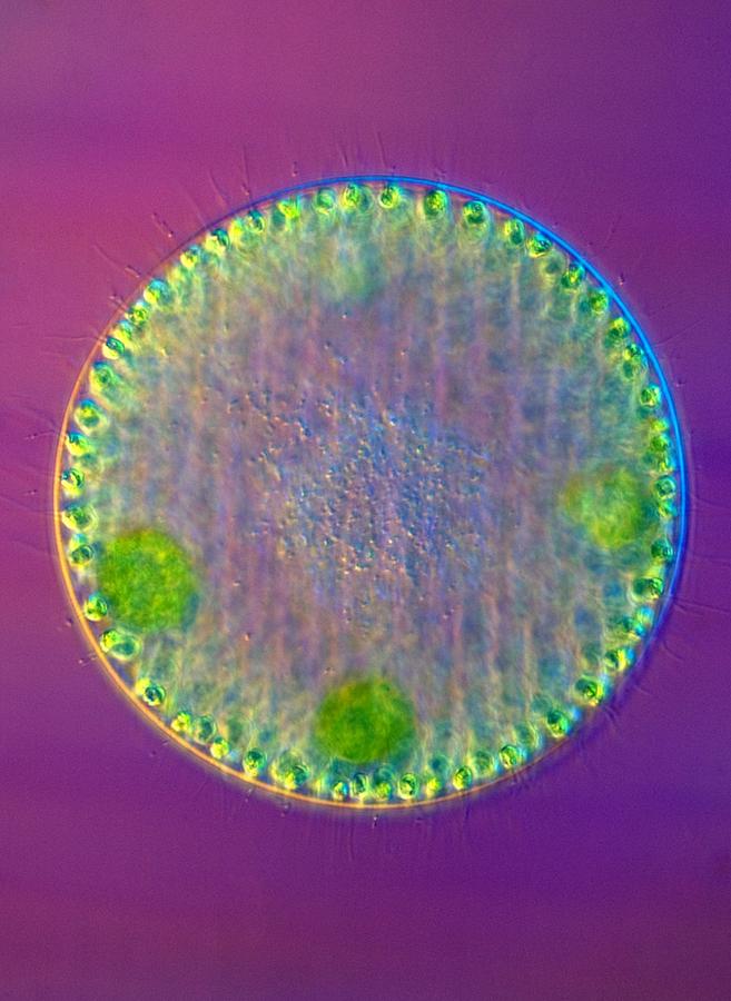 Volvox Colony, Light Micrograph by Sinclair Stammers / Science Photo ...