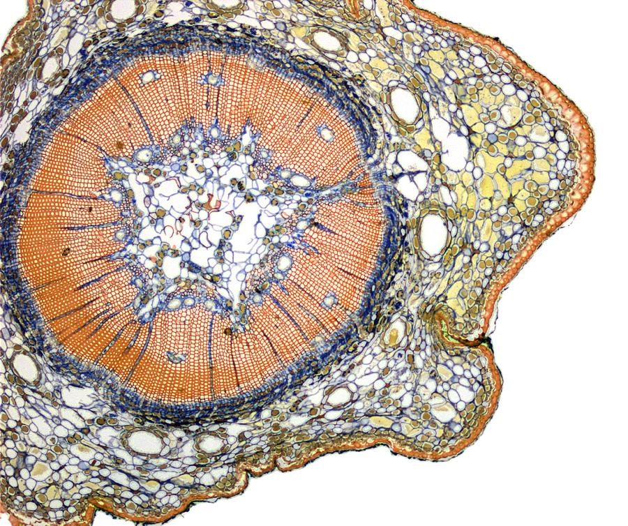 Young Pine Tree Stem, Light Micrograph by Steve Gschmeissner / Science ...