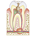 Cross Section Biomedical Illustration Of Pulp And Root Abscess In Molar ...