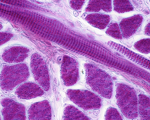 Skeletal Muscle Striations