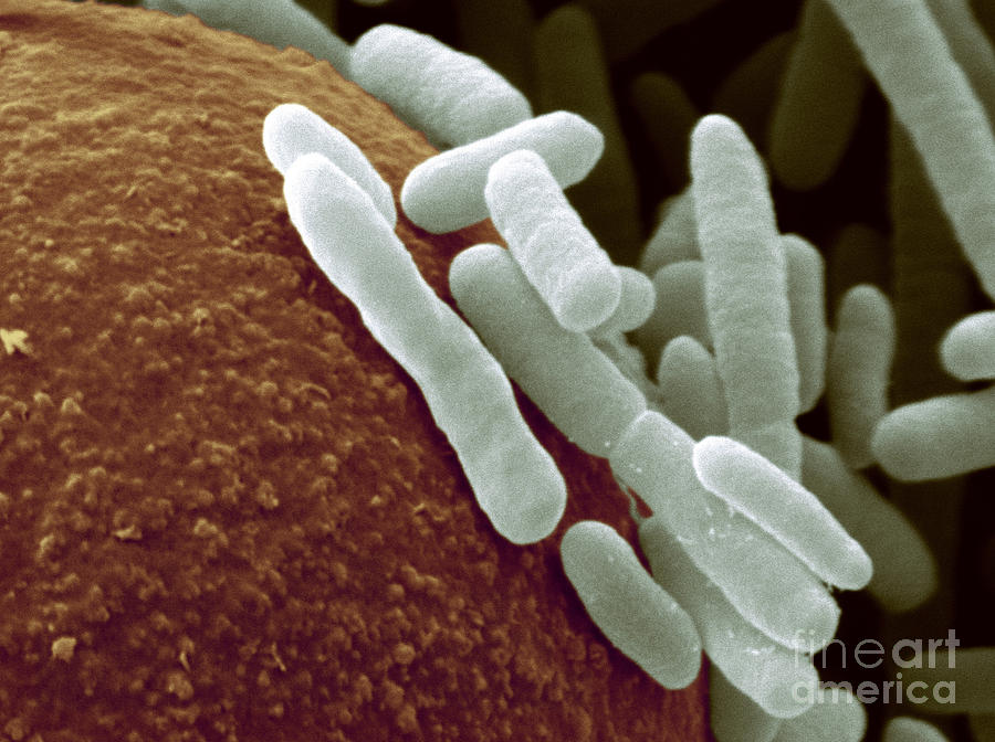 Escherichia Coli Photograph by Scimat - Fine Art America