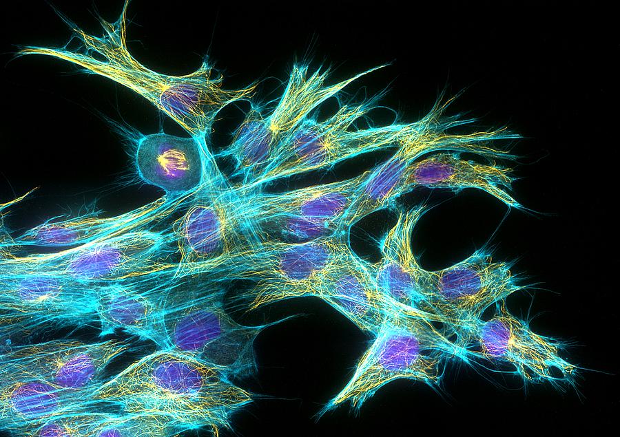 Fibroblast Cells, Fluorescent Micrograph Photograph by Dr Torsten Wittmann