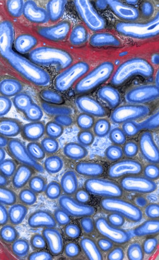 Testicle Digital Art by Naomi Glogowski