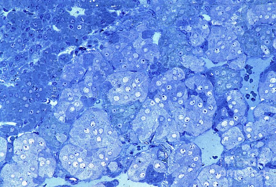 Adrenal Gland Cortex And Medulla Photograph By Jose Calvo Science