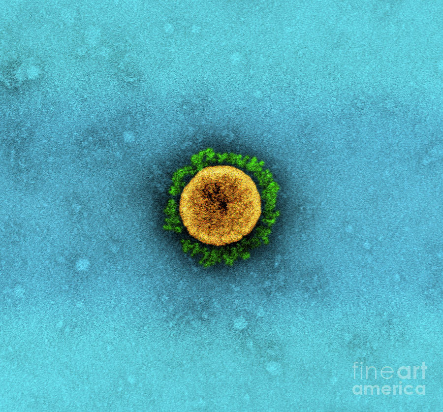 Alpha Variant Covid-19 Coronavirus Particle Photograph by National ...