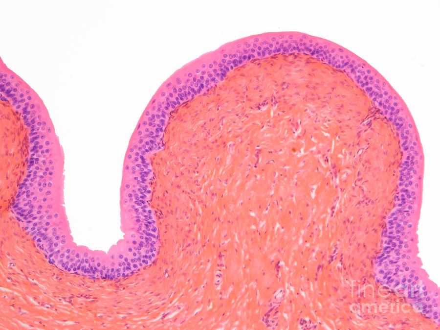 Bladder #1 by Science Photo Library