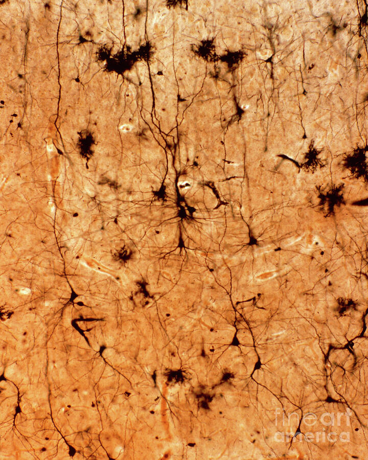 Cerebral Cortex Pyramidal Neurons 1 By Jose Calvo Science Photo Library