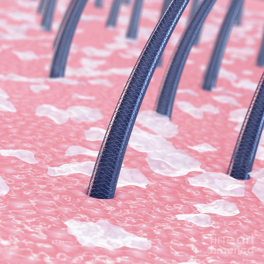 Dandruff #1 Photograph by Nobeastsofierce / Science Photo Library - Pixels