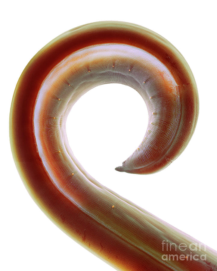 Dog Roundworm #1 by Science Photo Library