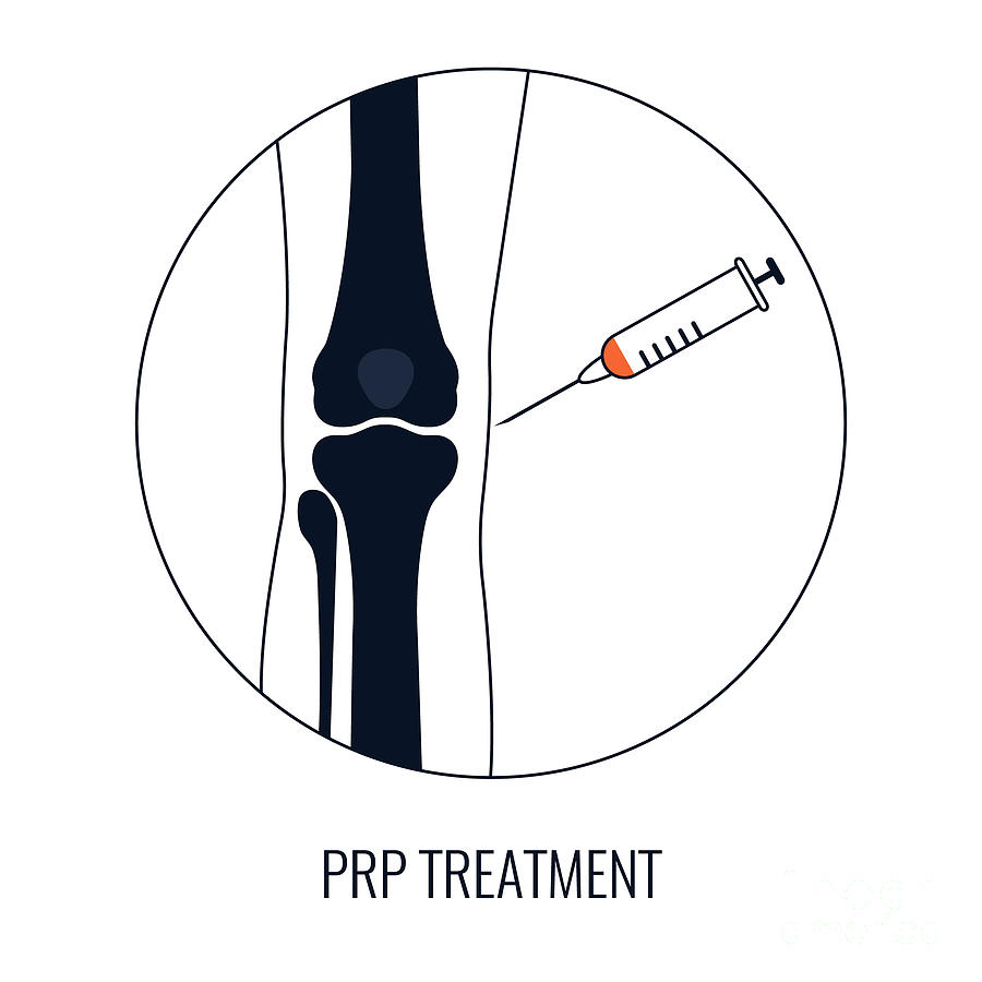 Knee Joint Injection Treatment Photograph by Art4stock/science Photo ...