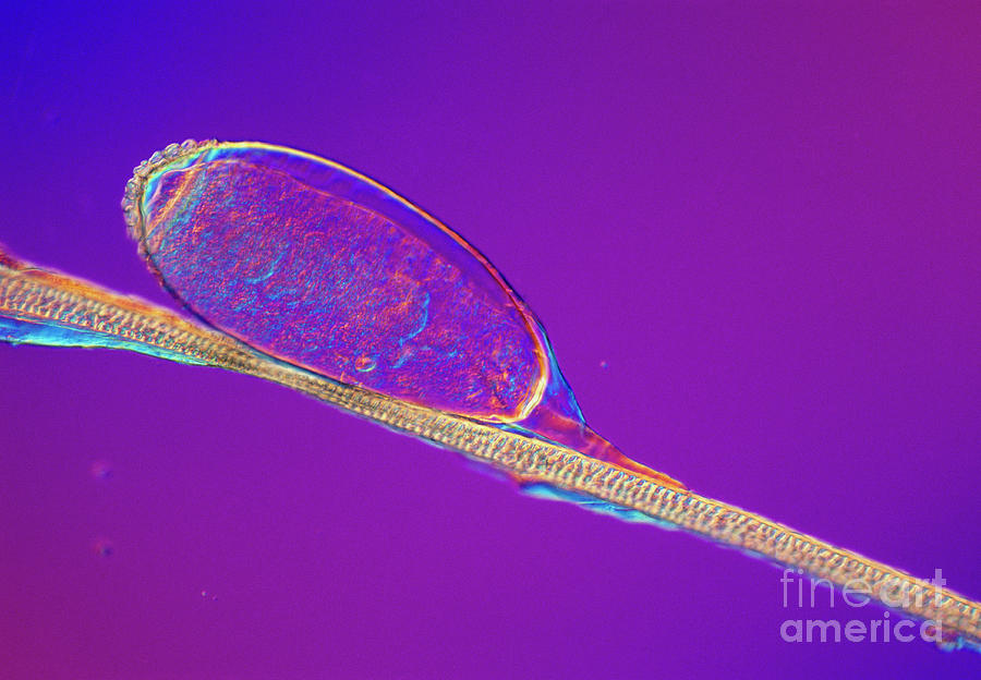 Lm Of Nit (egg Case) Of Human Head Louse Pediculus Photograph by Astrid & Hanns-frieder Michler ...