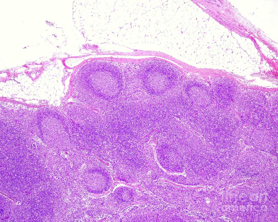 Lymph Node Cortex Photograph by Jose Calvo/science Photo Library | Pixels