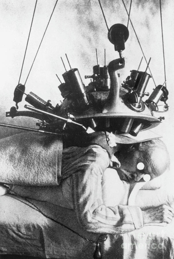 Man Having Neck Cancer Treated By Radium Therapy Photograph by Science ...