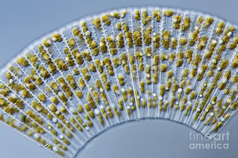 Meridion Circulare Diatoms Photograph by Gerd Guenther/science Photo ...