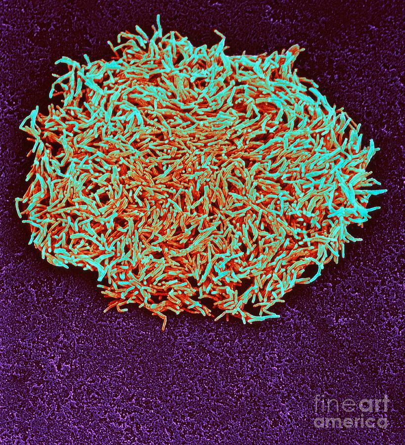 Mycobacterium Tuberculosis Bacteria #1 by Science Photo Library