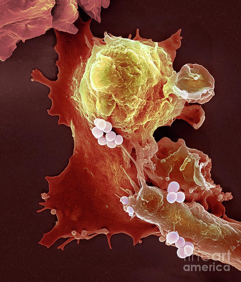 Neutrophil Engulfing Staphylococcus Aureus Bacteria Photograph by ... Neutrophil Engulfing Staphylococcus Aureus Bacteria Photograph by ...