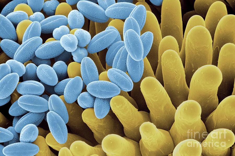 Self-incompatibility Of Brassica Pollen #1 Photograph by Science Photo ...