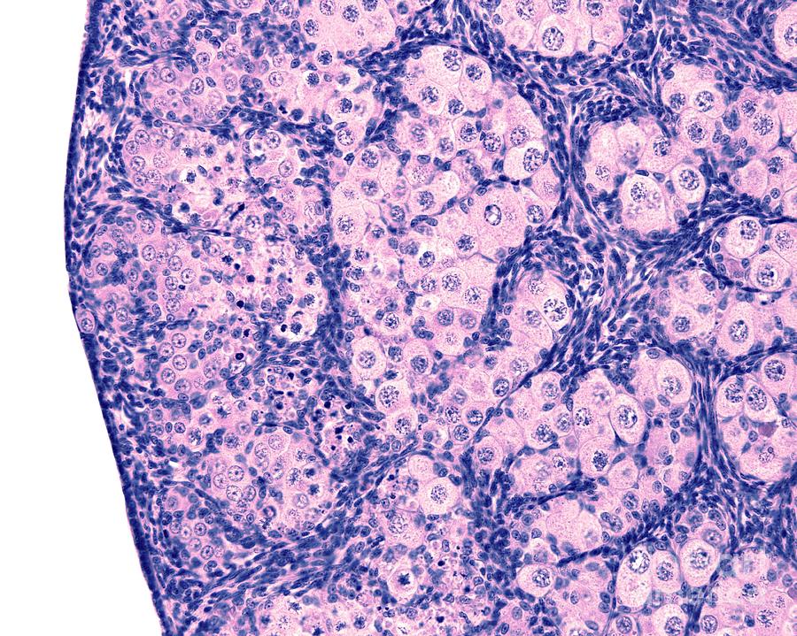 Sex Cords In A Fetal Ovary Photograph By Jose Calvo Science Photo Library Pixels