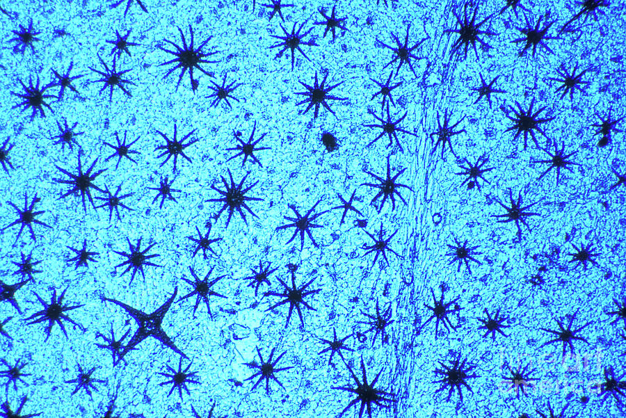 Stellate Leaf Hairs 1 Photograph By Science Photo Library Pixels Merch