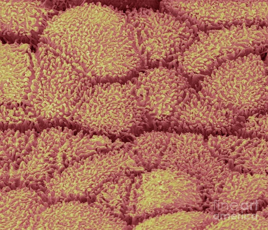 Urethra Photograph by Steve Gschmeissner/science Photo Library - Pixels