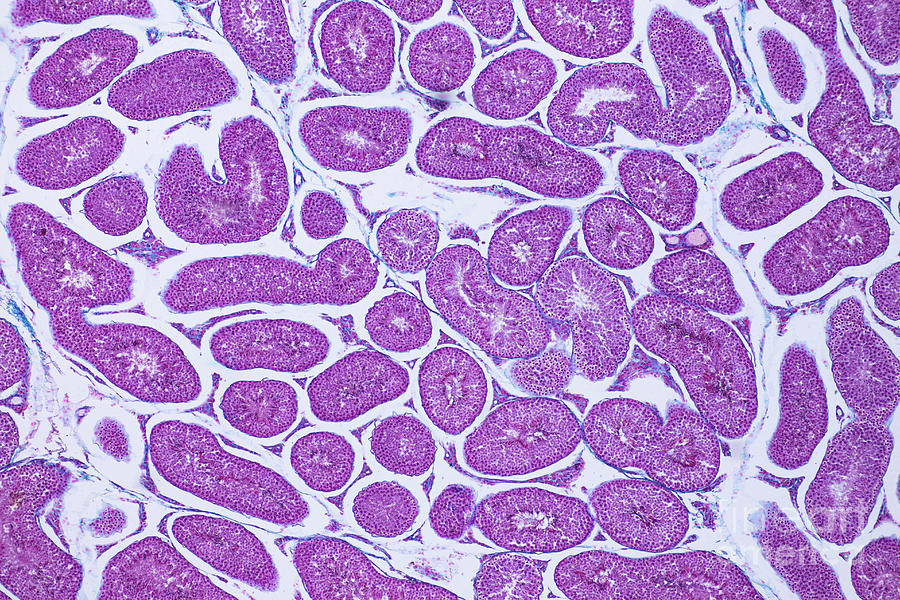 Human Testis Photograph By Choksawatdikorn Science Photo Library Pixels