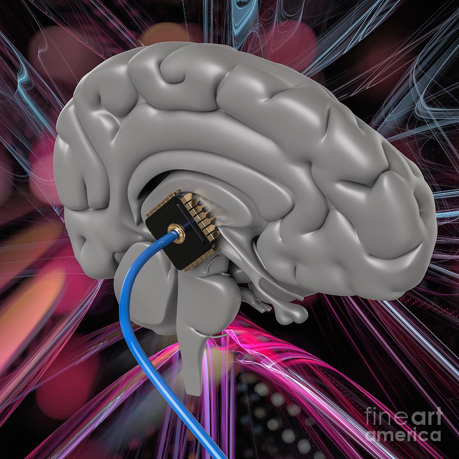 Brain-computer Interface #11 by Science Photo Library