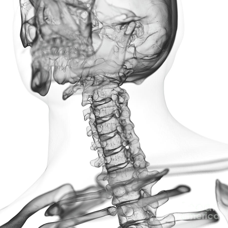 Cervical Spine Cervical Spine