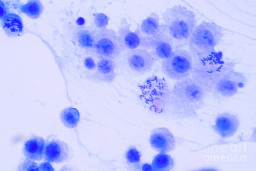Mitosis Photograph By Choksawatdikorn Science Photo Library Pixels