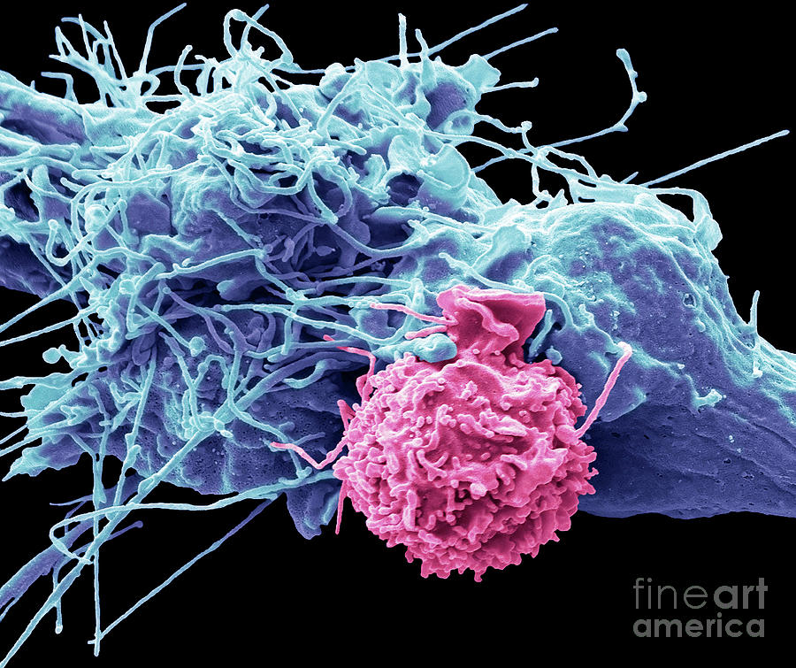 Natural Killer Cell And Cancer Cell Photograph by Steve Gschmeissner/science Photo Library ...