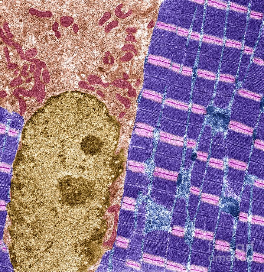Striated Muscle Photograph by Steve Gschmeissner/science Photo Library ...
