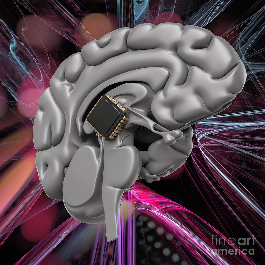 Brain-computer Interface Photograph by Laguna Design/science Photo ...