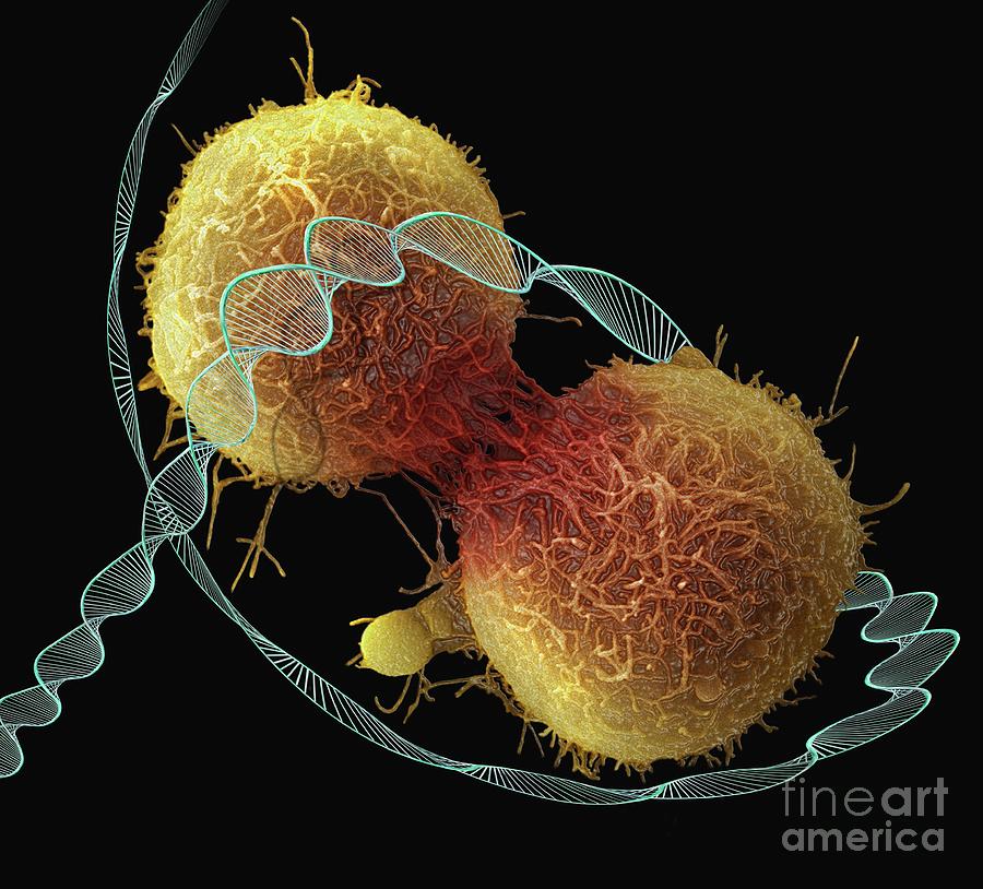 Cancer And Dna Photograph by Steve Gschmeissner & Keith Chambers ...