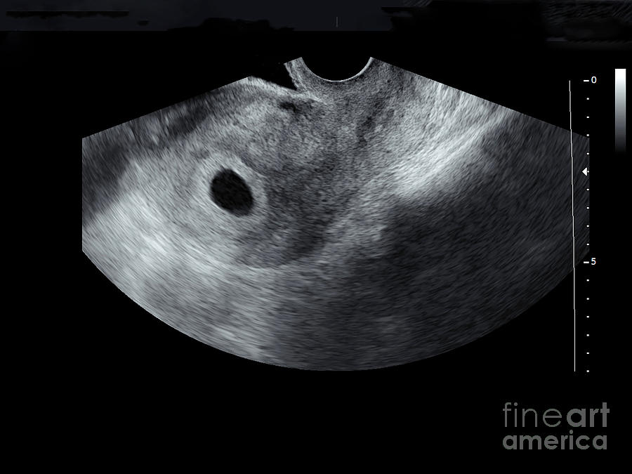 Embryo At Six Weeks Photograph by Dr Najeeb Layyous/science Photo ...