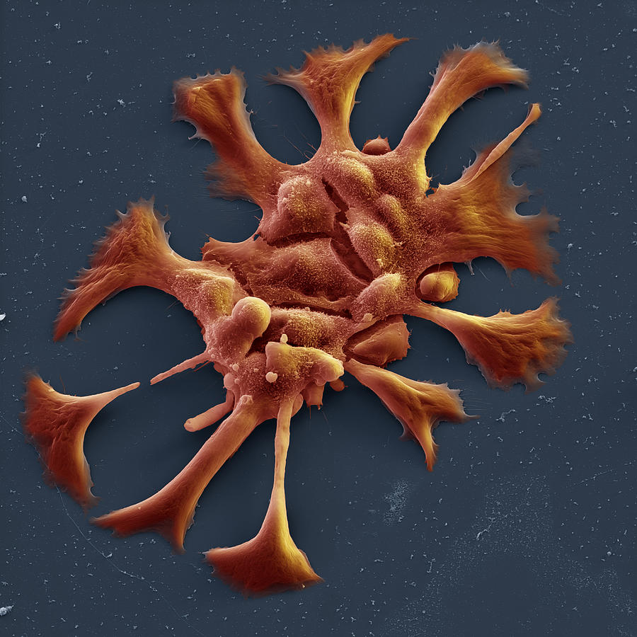 Liver Cells Sem Photograph by Meckes/ottawa - Fine Art America