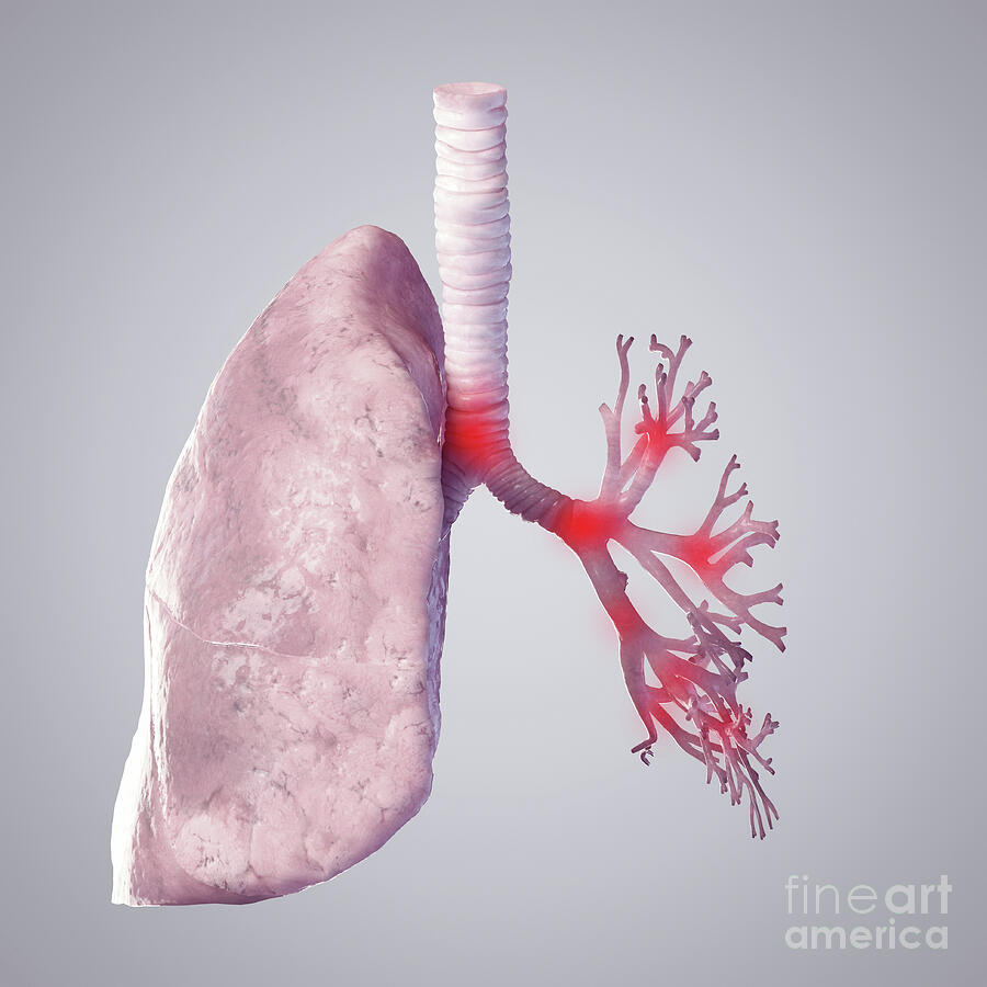Lung And Bronchi #2 by Sebastian Kaulitzki/science Photo Library