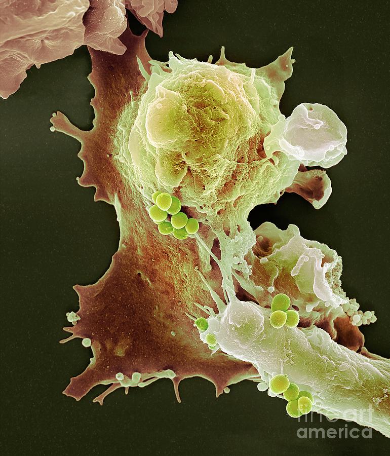 Neutrophil Engulfing Staphylococcus Aureus Bacteria Photograph by ... Neutrophil Engulfing Staphylococcus Aureus Bacteria Photograph by ...