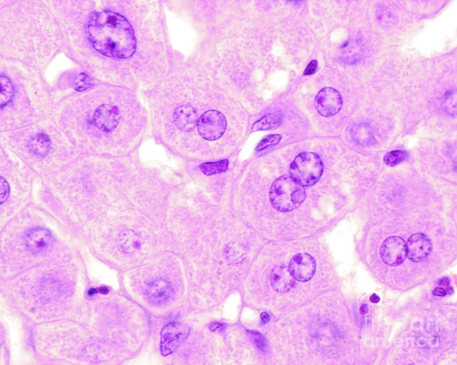 Polyploid Liver Cells Photograph by Jose Calvo / Science Photo Library ...