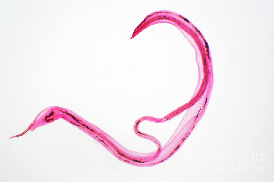 Whipworm Photograph by Choksawatdikorn / Science Photo Library - Fine ...