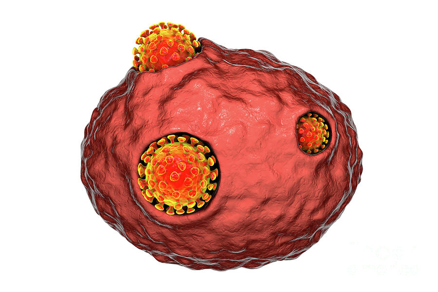 Covid-19 Coronaviruses Infecting Human Cells Photograph by Kateryna Kon/science Photo Library ...