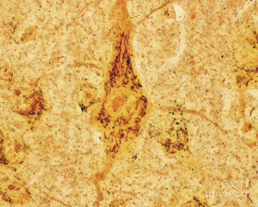 Cerebellar Cortex 27 By Jose Calvo Science Photo Library