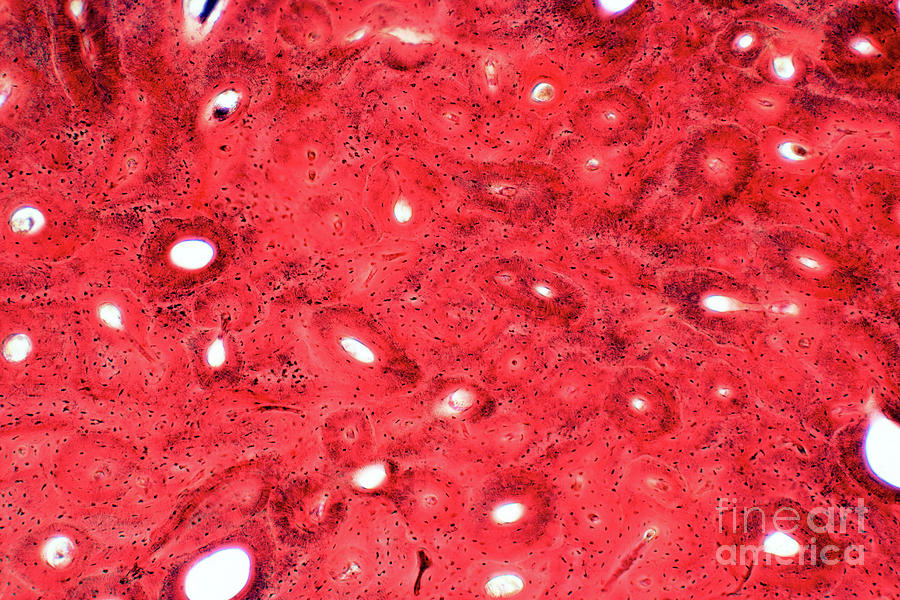 Human Compact Bone Photograph by Choksawatdikorn / Science Photo ...