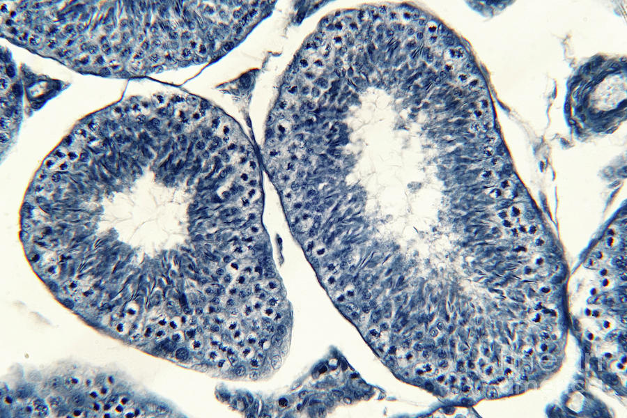 Human Testis Photograph By Choksawatdikorn Science Photo Library Pixels