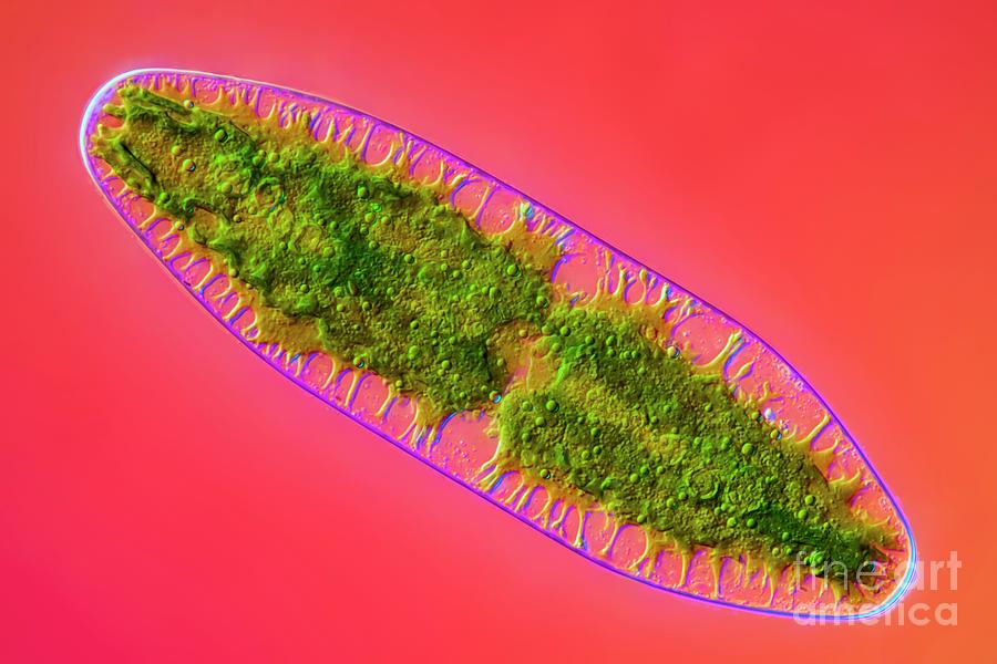 Netrium Algae #3 by Science Photo Library