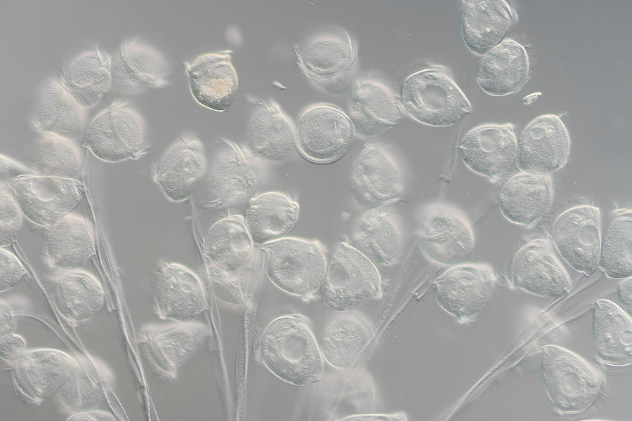 Peritrich, Dic Microscopy Photograph by Karl Gaff - Fine Art America