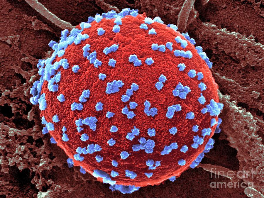 Cell Infected By Sars-cov-2 Virus Particles Photograph by Science Photo Library - Fine Art America