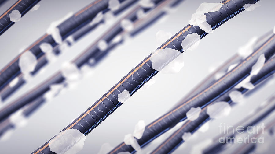 Dandruff #4 by Science Photo Library