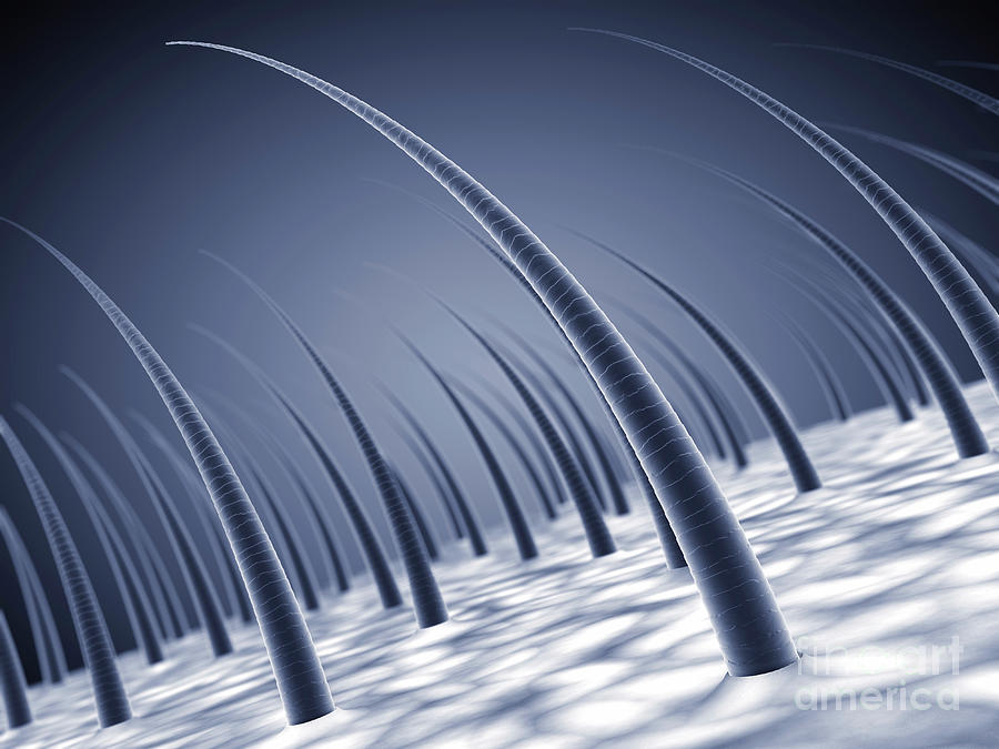 Human Scalp Photograph by Nobeastsofierce/science Photo Library - Fine ...